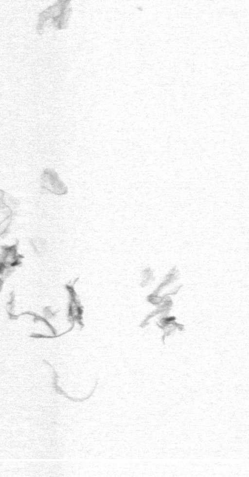 Stem Detection Instance Segmentation Dataset By Sd