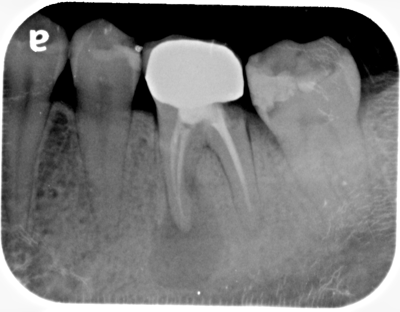 teeth Semantic Segmentation Dataset (v5, 2024-10-01 2:48pm) by teeth3