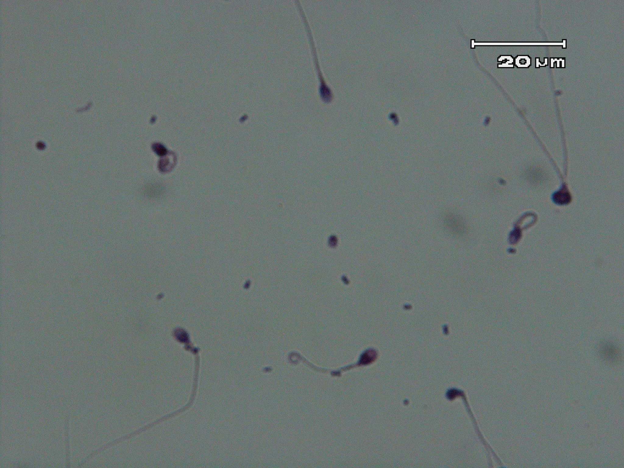 My Dataset Sperm Detection Object Detection Dataset By Golara Refahi