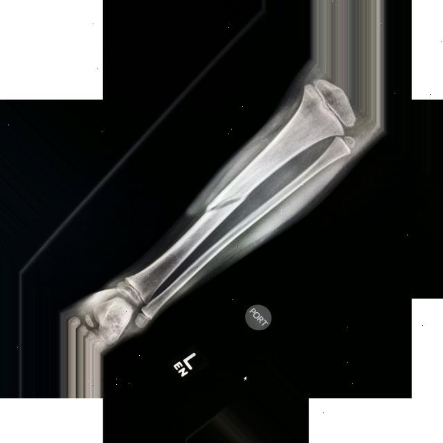 Limb Object Detection Dataset by Student