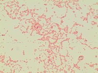 Fecal Egg Counting Roboflow Universe