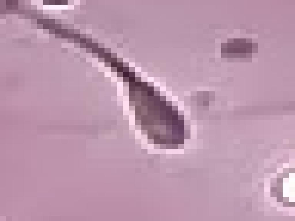 mediapipe_sperm Object Detection Dataset by Train