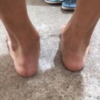 Leg Tracking - Roboflow Universe