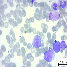 leukemia-original Object Detection Dataset by custom yolov5