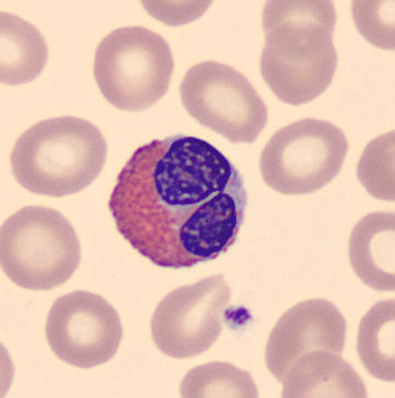 Blood_Cell_Classification Object Detection Dataset and Pre-Trained ...