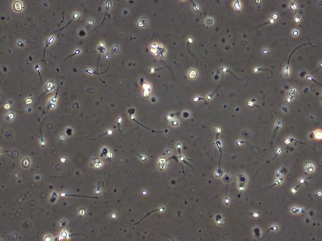 Types Of Sperm Cells Object Detection Dataset By Seram Cell Detection