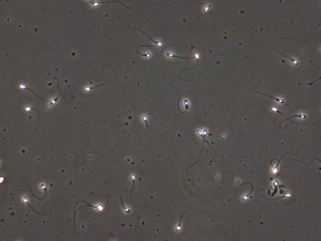 sperm-detection-semantic-segm Semantic Segmentation Model by Yazgan