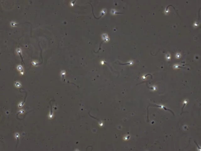 sperm_video_detection Object Detection Dataset by Yazgan