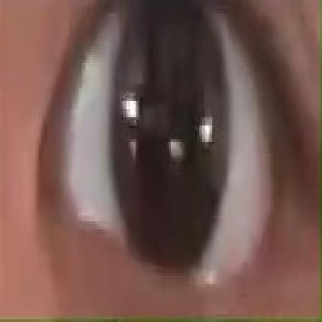 Eye Iris Detection Object Detection Dataset by serhat