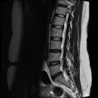 Roboflow 100-VL (rf100-vl) - Roboflow Universe