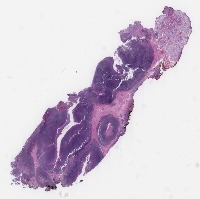 ygtfr Instance Segmentation Model by blah