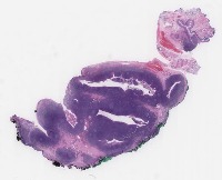 ygtfr Instance Segmentation Model by blah