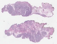 ygtfr Instance Segmentation Model by blah