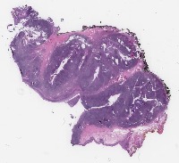 ygtfr Instance Segmentation Model by blah