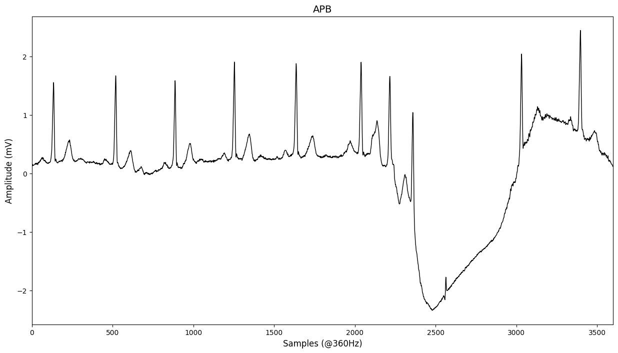 ECG_REVISED Object Detection Dataset by ECG
