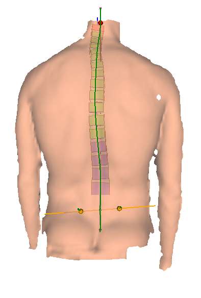 Vertebra Detection2 Instance Segmentation Dataset And Pre Trained Model