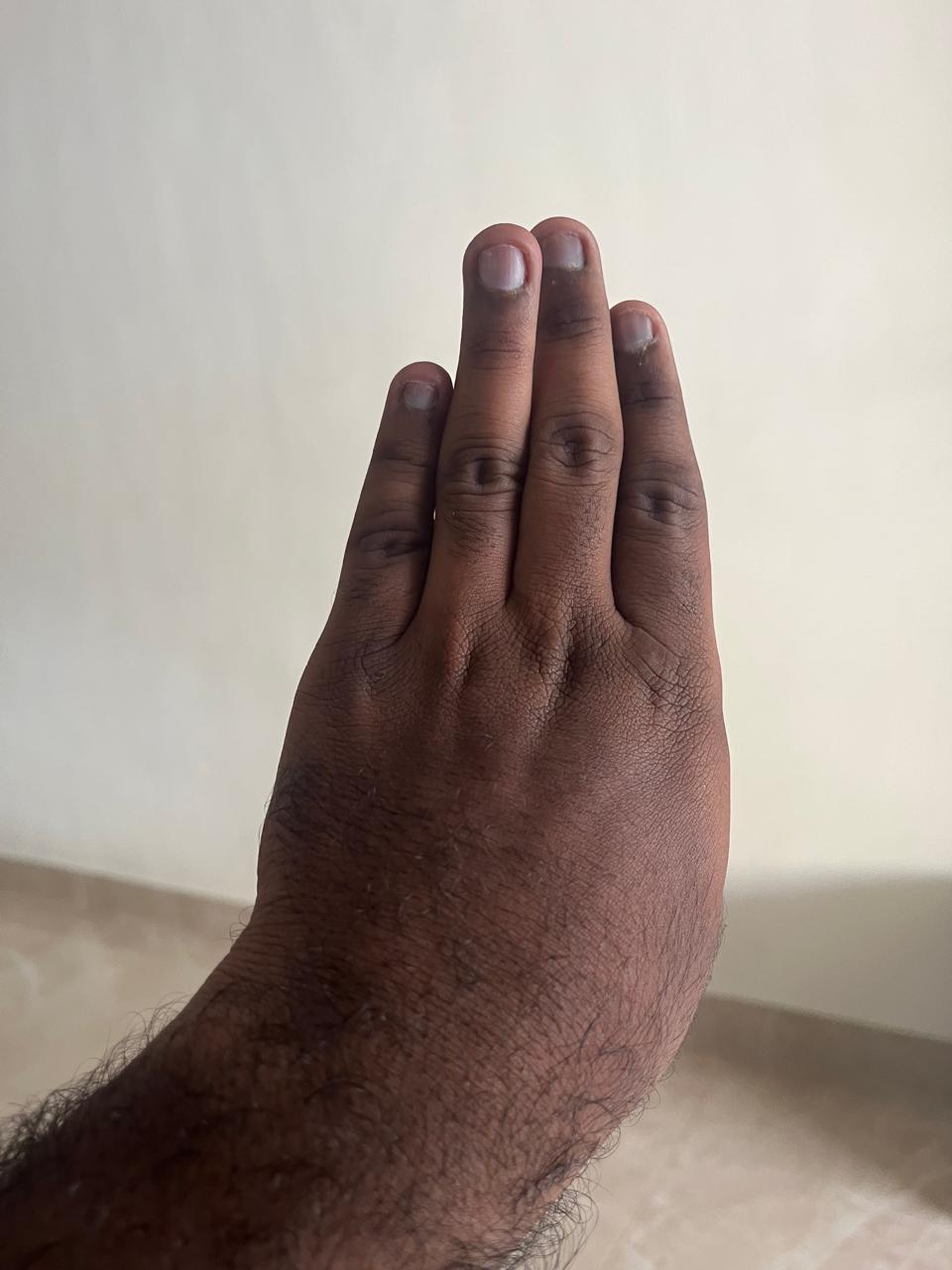 SOS gesture Keypoint Detection Dataset by Sri