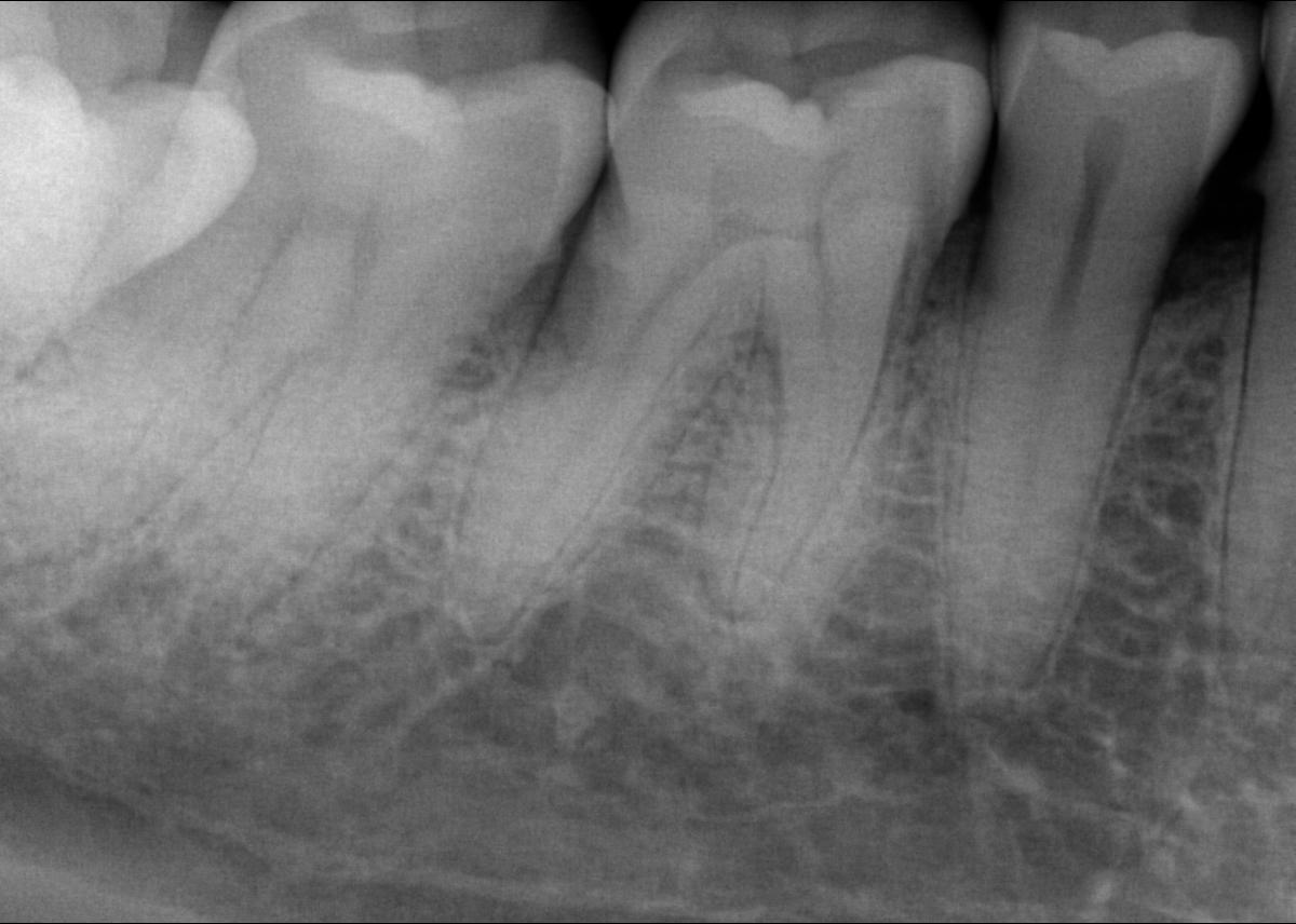 Dental Structure Detection Dataset And Pre Trained Model By Dental