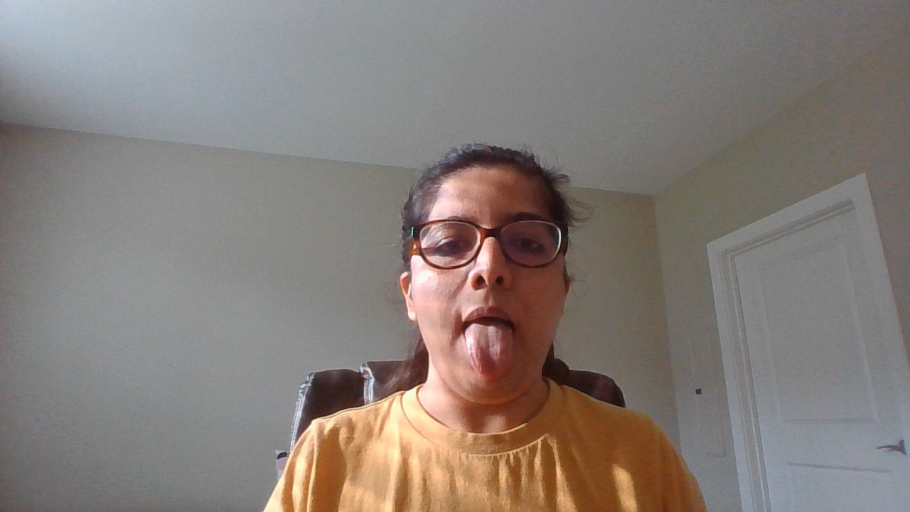 MedAdhere AI Pill on Tongue Detector Object Detection Dataset and Pre ...