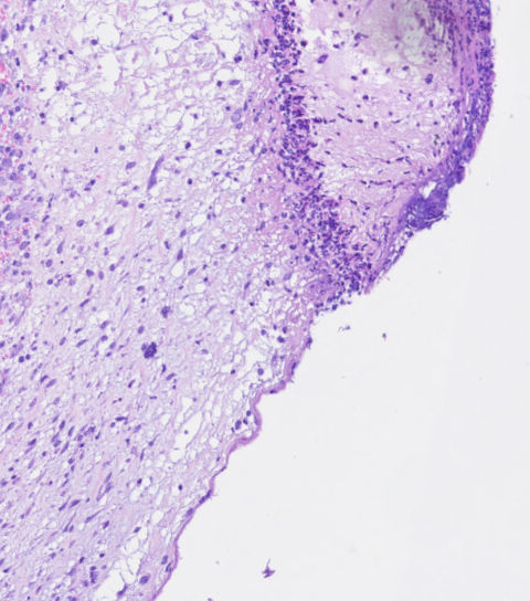 skin_DATA Object Detection Model by Helens workspace