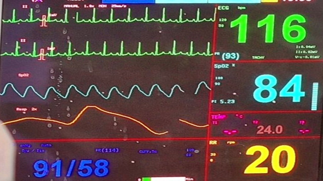 EliteViewDatasetA Object Detection Dataset by Balls