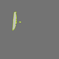 Scratch Detection (scratch-detection-cso6i) - Roboflow Universe