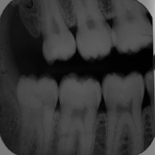 Bitewing_twoside Instance Segmentation Dataset by Thammasart University