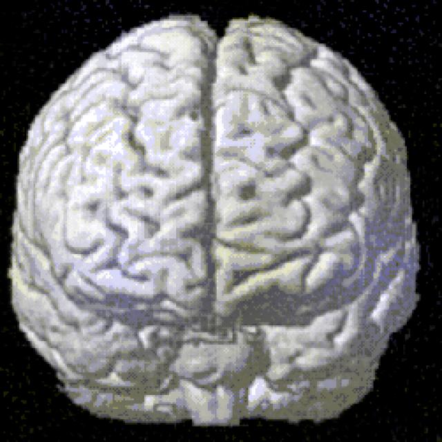 Brain Normal_Autistic test Object Detection Dataset by Halima
