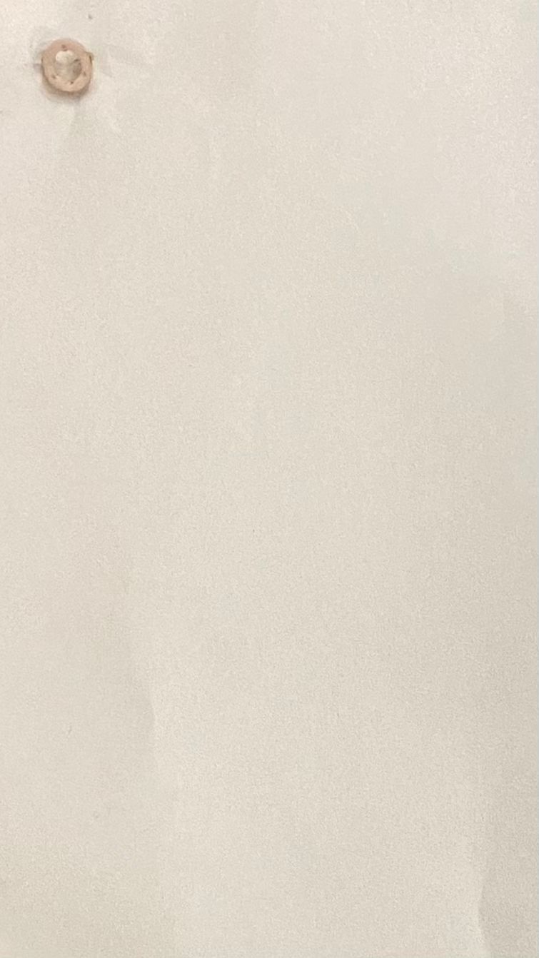 Detection Diameter Roboflow Universe