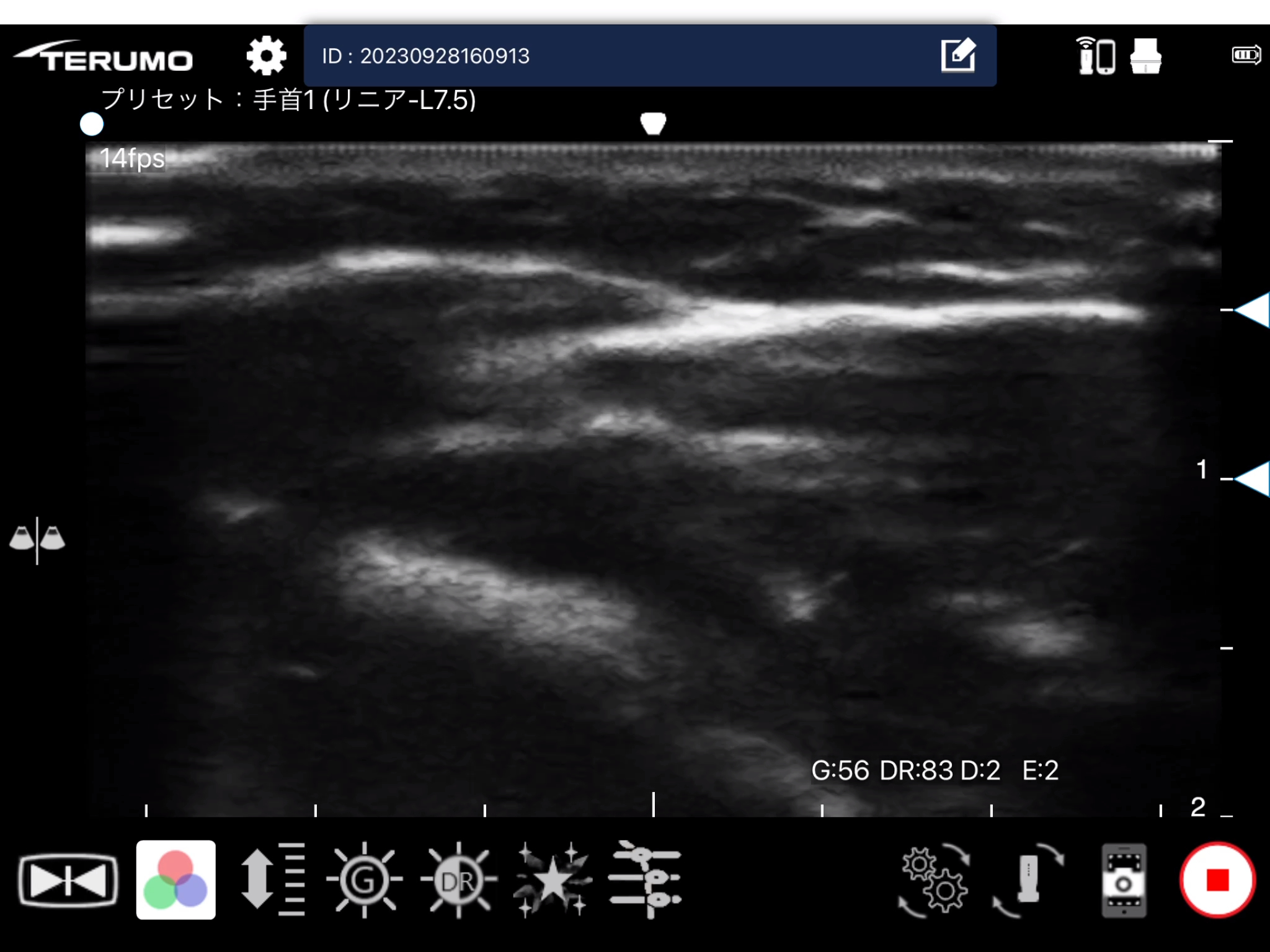 yolox_val Object Detection Dataset by new-workspace-xi3y5