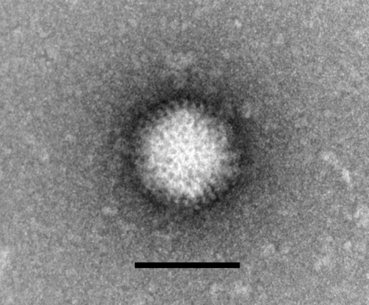 Virus Segmentation Object Detection Model by virussegmentation