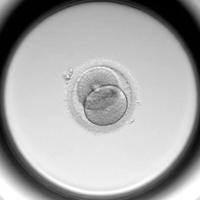 test data set oocyte Object Detection Model by praveen s