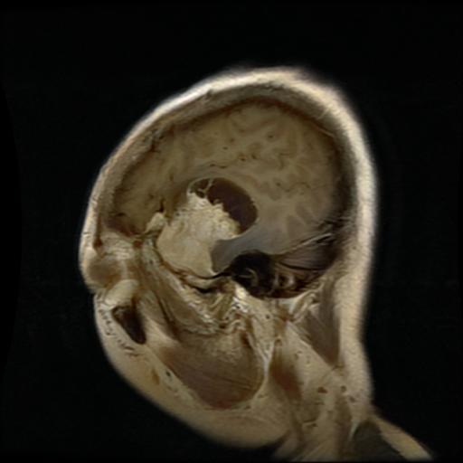 Welding Object Detection Model by HelloROBO