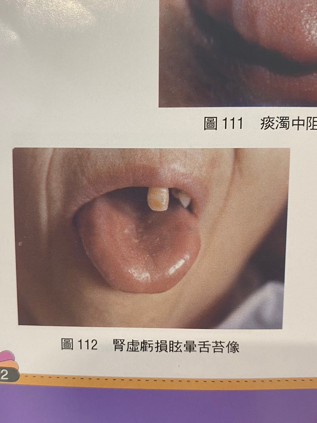 POC-LS-ROBOFLOW Object Detection Dataset and Pre-Trained Model by skripsi