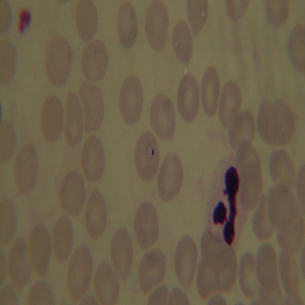 red-blood-cells Instance Segmentation Dataset and Pre-Trained Model by ...