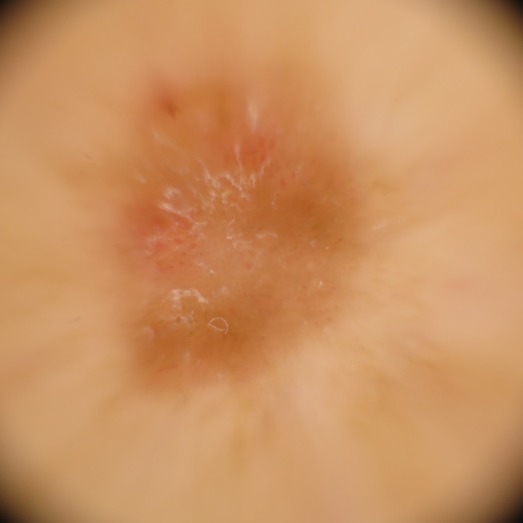 disease detection Instance Segmentation Dataset and Pre-Trained Model by skydrow1201