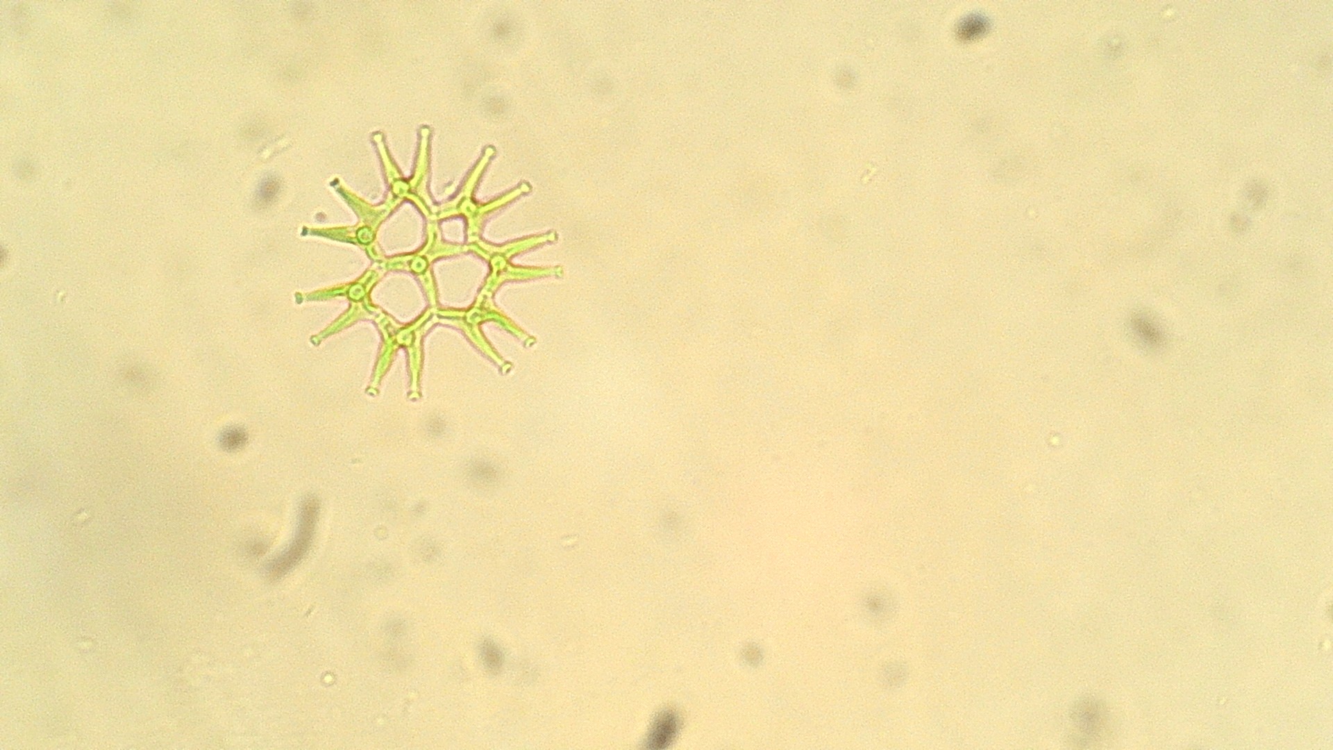 Detect Microalgae Object Detection Dataset By Algae