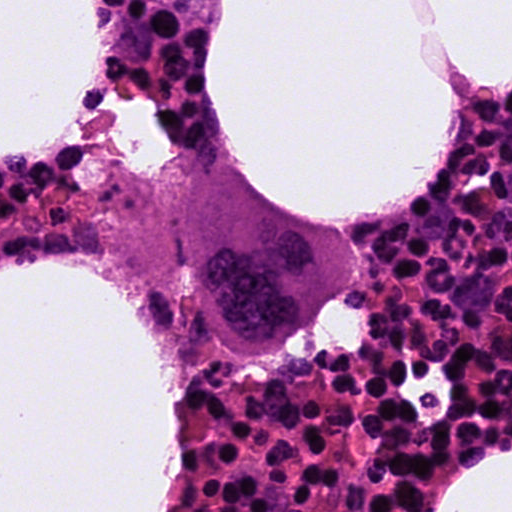 megakaryocyte cell segmentation Instance Segmentation Dataset and Pre-Trained Model by Julia