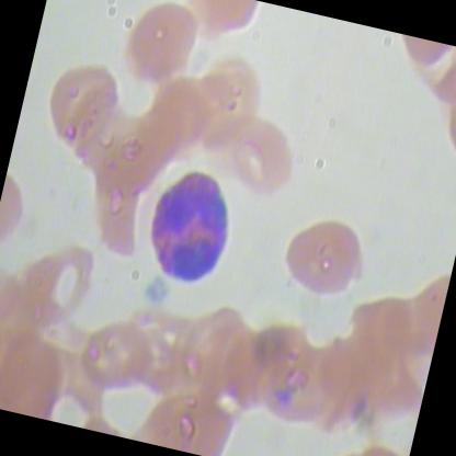blood-cell Object Detection Model by Roboflow