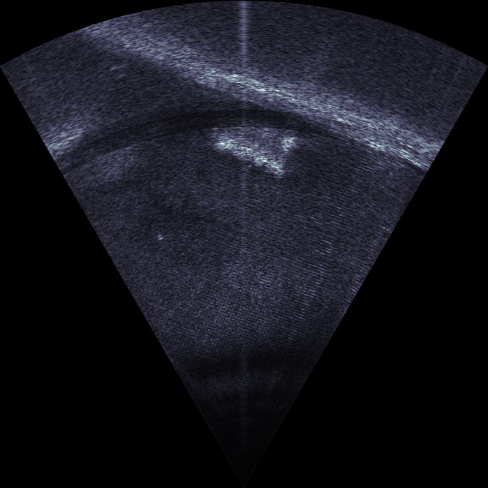Sonar Images Object Detection Dataset By Mrgsonardetector
