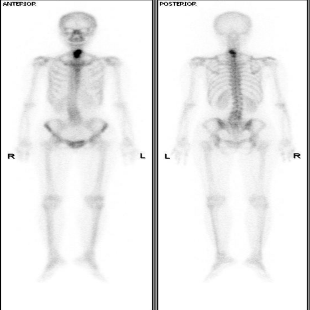 scalebox Object Detection Dataset by IIR