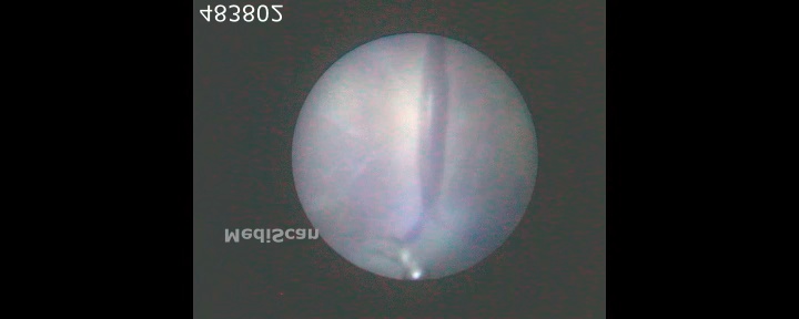 Auto Annotations Object Detection Dataset By Fetal Img Annot
