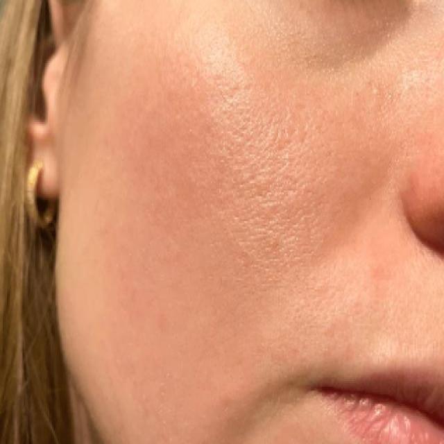 pores Instance Segmentation Model (v1, 2024-10-08 2:58pm) by Harsh