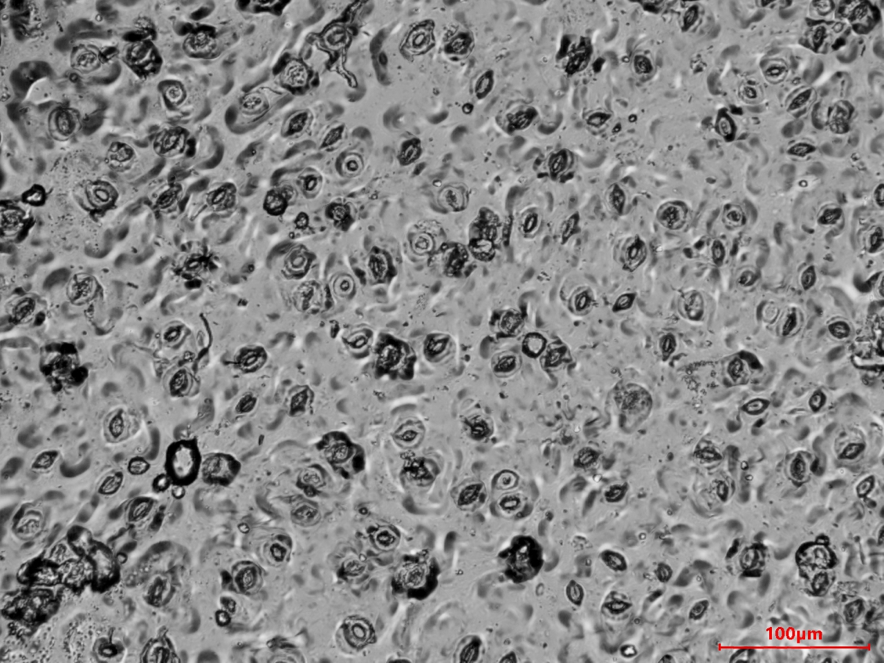 Arabidopsis Stomatal Counting Object Detection Model By Oleksii