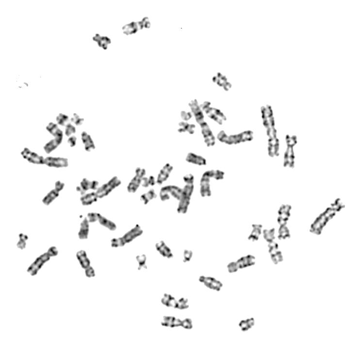 Chromosome v.4 Object Detection Model by KKU