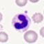 cancer-celll Object Detection Dataset by Trialplace