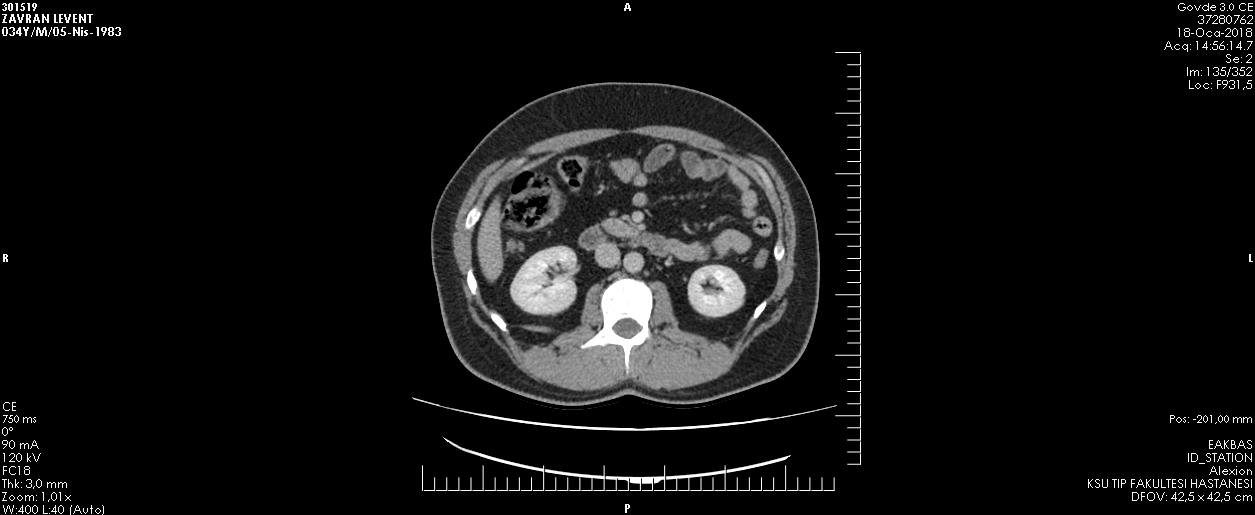 Appendicitis detection Classification Dataset by Appendicitis detection ...