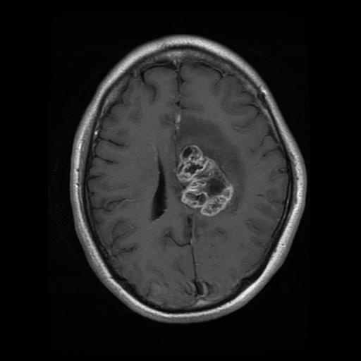 DSA aneurysm Object Detection Dataset and Pre-Trained Model by ysw25knu