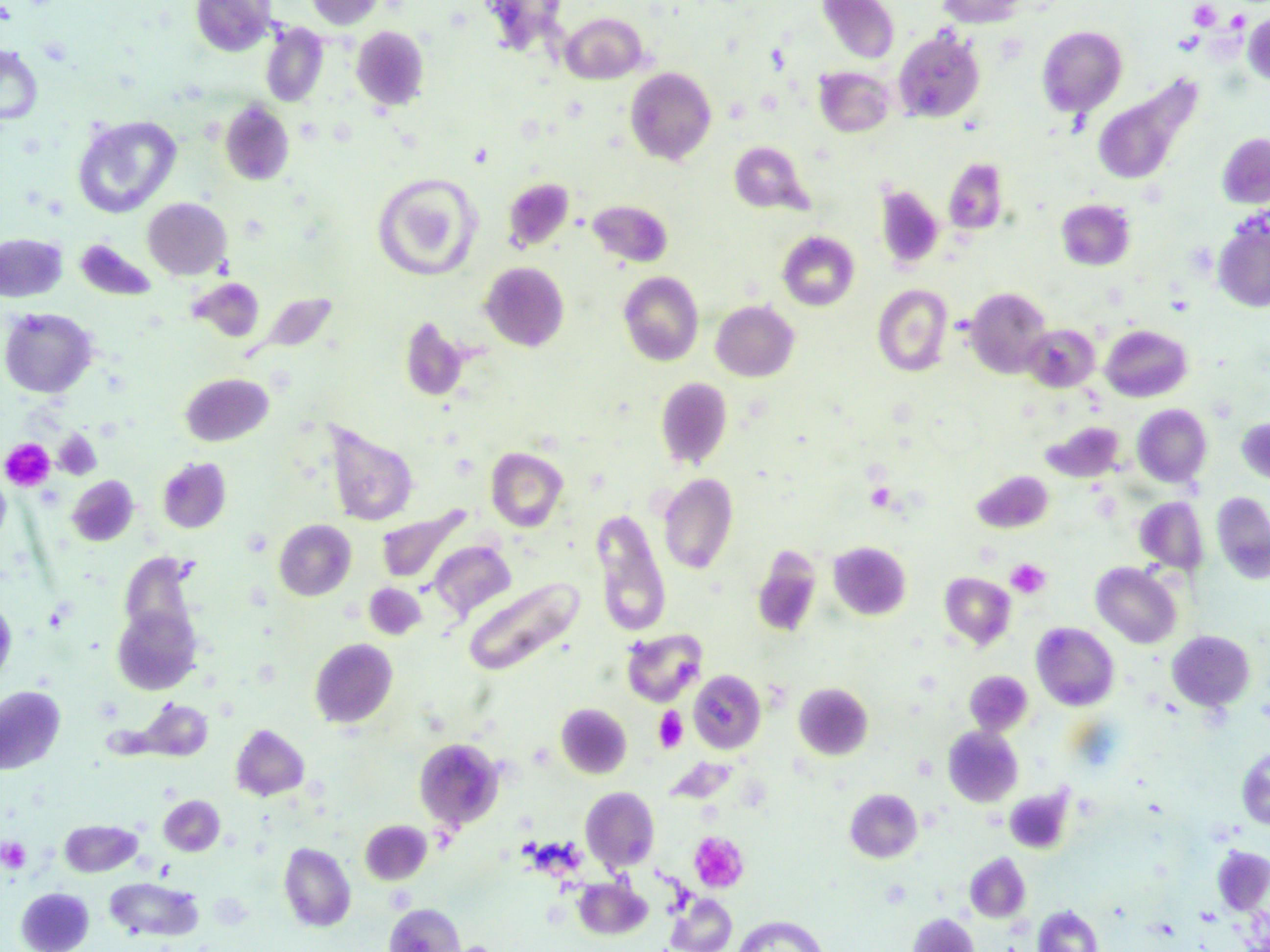 Blood Cell Hypochromic Object Detection Dataset by DML