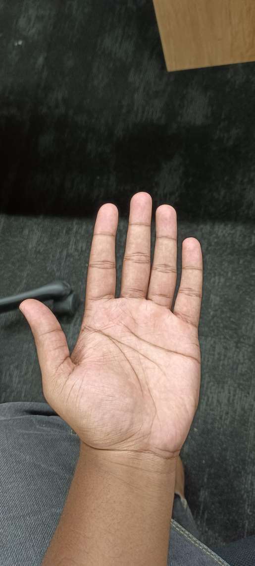 palmdetection - Roboflow Universe